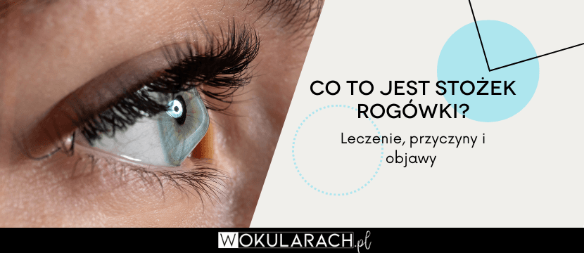 Co to jest stożek rogówki? Leczenie, przyczyny i objawy | wOkularach.pl