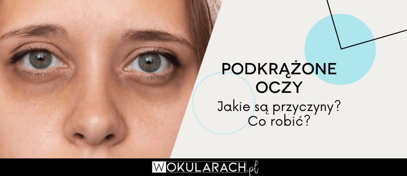 Podkrążone oczy - jakie są ich przyczyny i jak sobie z nimi radzić ...