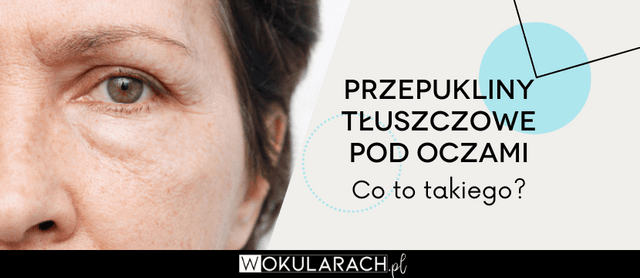 Przepukliny tłuszczowe pod oczami — co to takiego? | wOkularach.pl